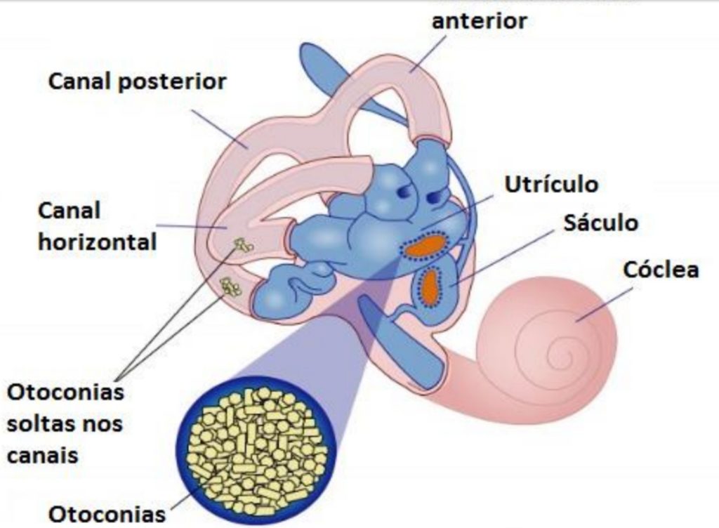 VPPB - Vertigem Posicional Paroxística Benigna - CMT Clínica da dor